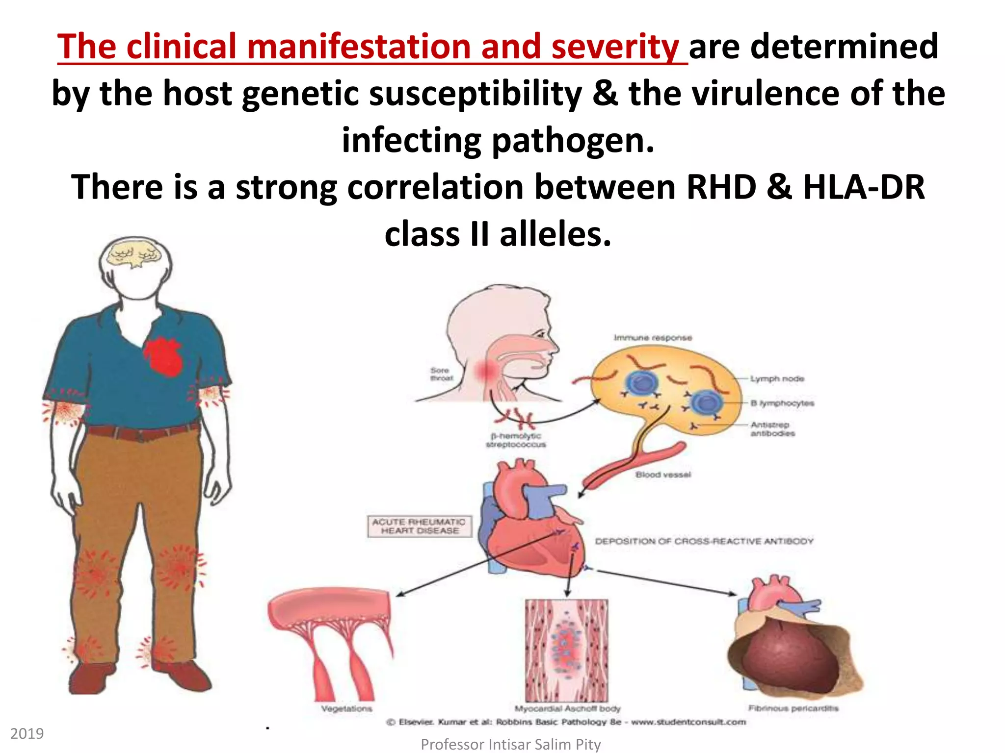Rheumatic fever, RHD, and infective endocarditis | PPTX