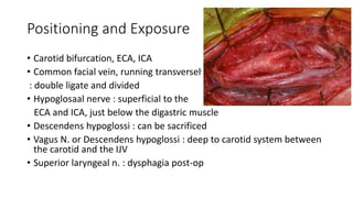 350 Carotid endarterectomy | PPT