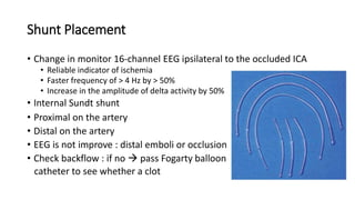 350 Carotid endarterectomy | PPT