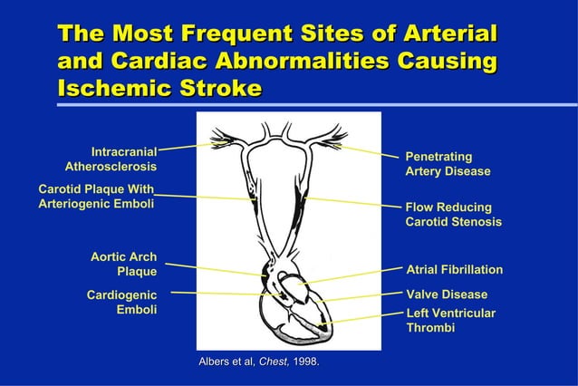 Stroke - clinical overview Stroke - clinical overview | PPT | Heart and ...