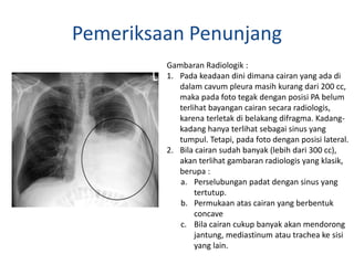 351383036-HEMATOTHORAX-ppt.pptx