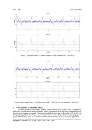 ECG signal denoising using a novel approach of adaptive filters for real-time processing | PDF
