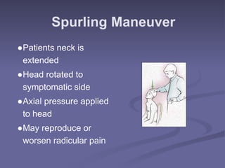 Spurling Maneuver