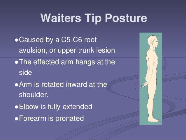 Cervical Radiculopathy Power Point.ppt