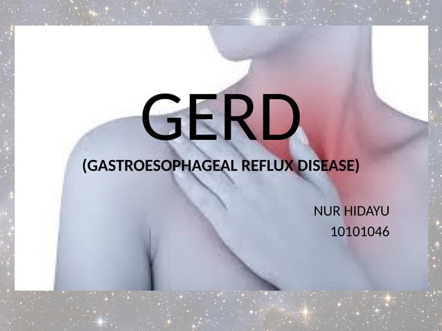354558499-gerd-ppt-ayu-pptx.pptcaaaaaaam | PPT