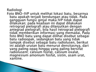 358484597 ureterolithiasis | PPTX