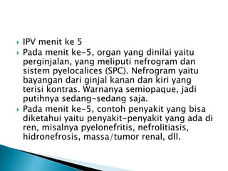 358484597 ureterolithiasis | PPTX