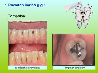 358995695-Ceramah-Kesihatan-Pergigian-Sekolah.ppt