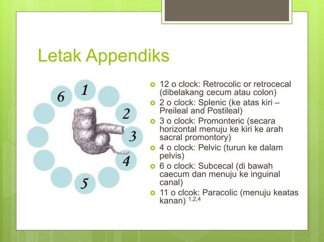359218810-Apendisitis-PPT.pptx