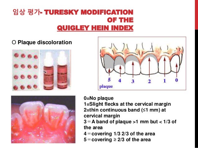 35 양지선 a graphic tool to help consumers determine when to replace a t…