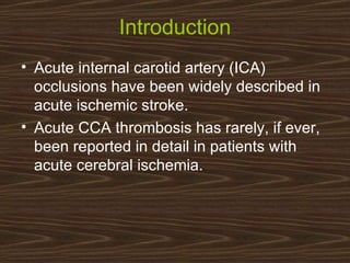 Thrombotic Occlusion Of The Common Carotid Artery | PPT