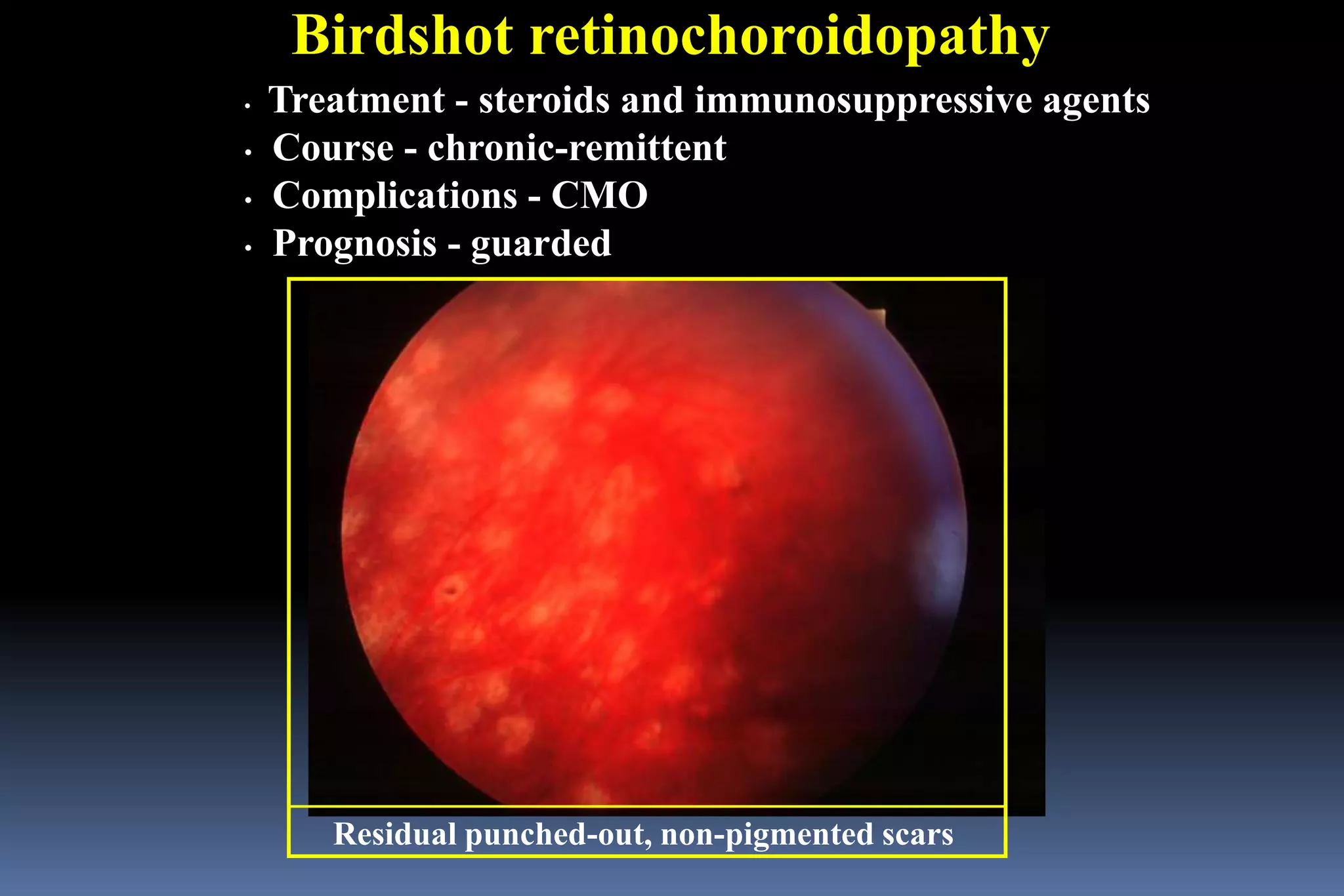 WHITE DOT SYNDROMES OF THE RETINAL INFLAMATION | PPT | Eye and Vision ...