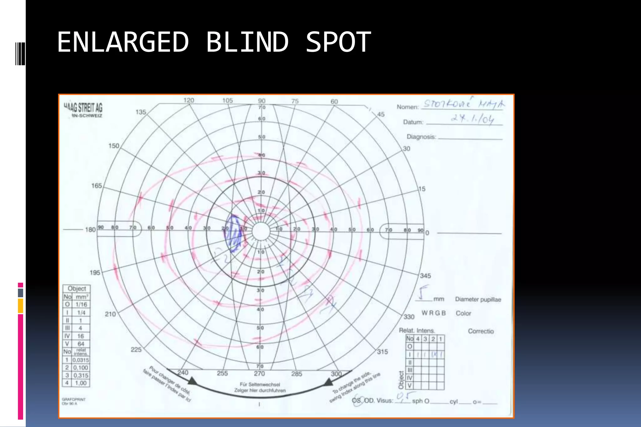 WHITE DOT SYNDROMES OF THE RETINAL INFLAMATION | PPT | Eye and Vision ...