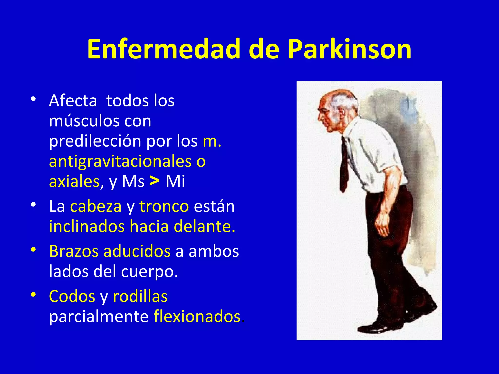 Síndrome extrapiramidal | PPT | Brain and Nervous System Disorders ...