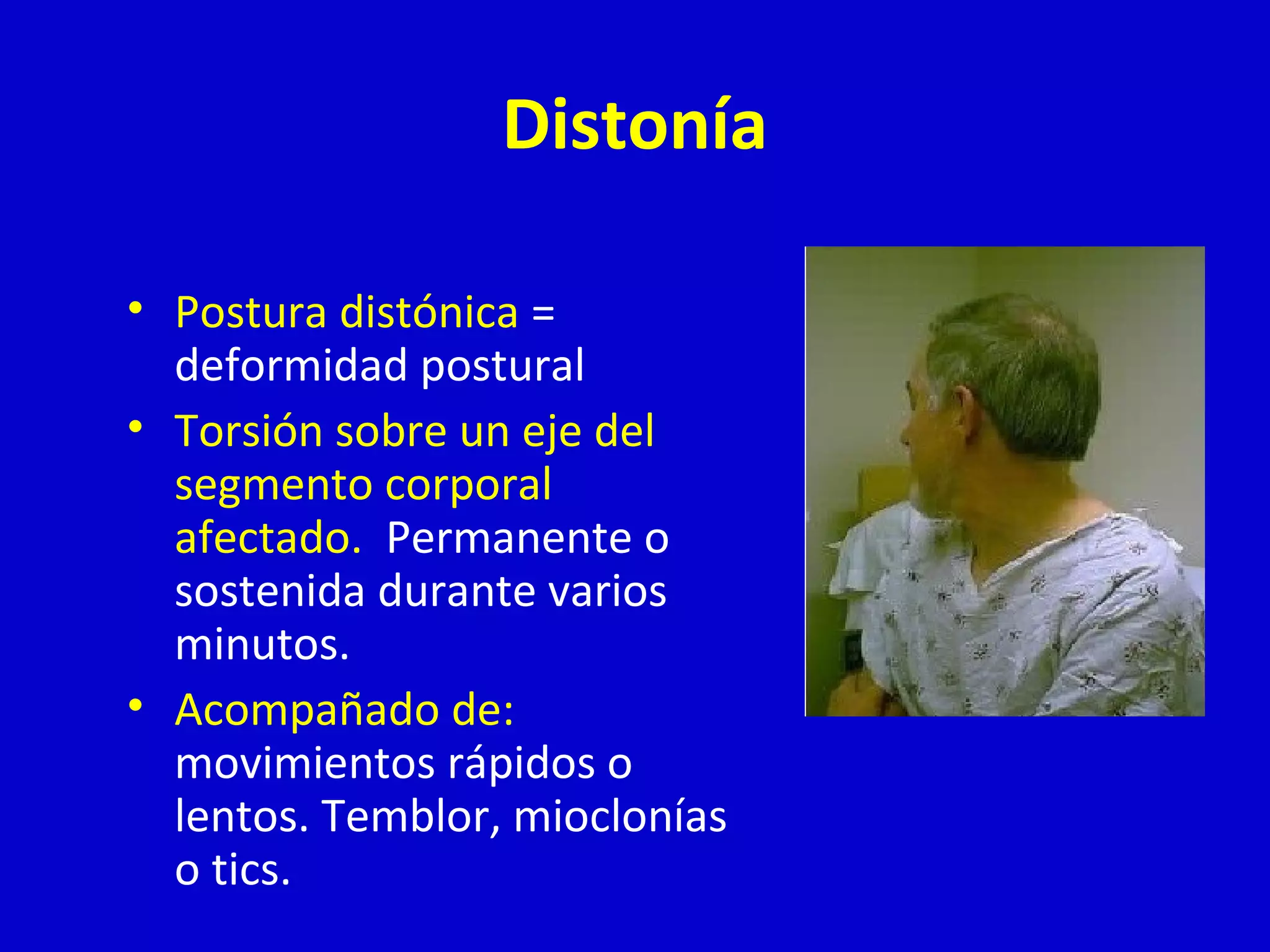 Síndrome extrapiramidal | PPT | Brain and Nervous System Disorders ...