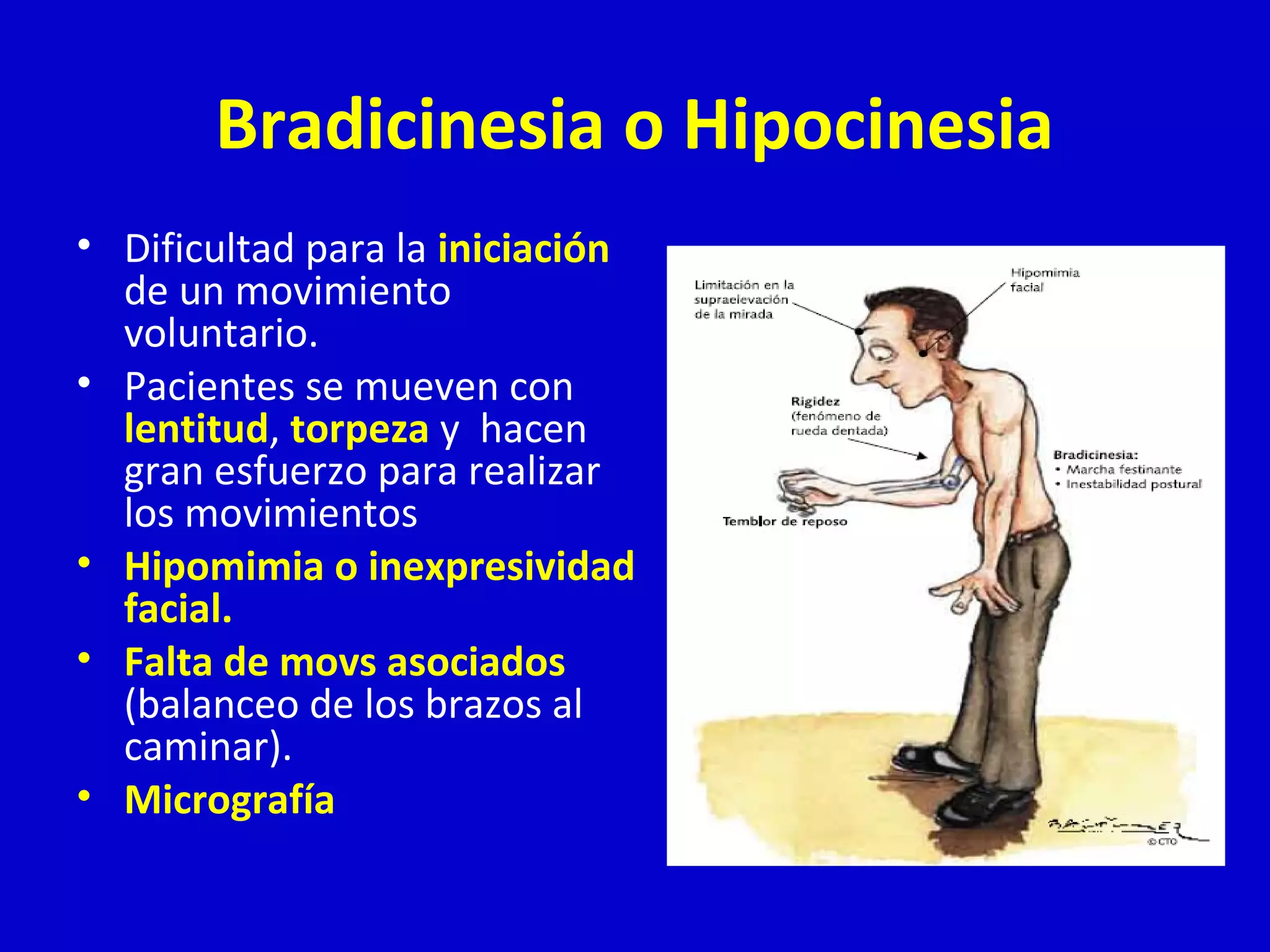 Síndrome extrapiramidal | PPT | Brain and Nervous System Disorders ...