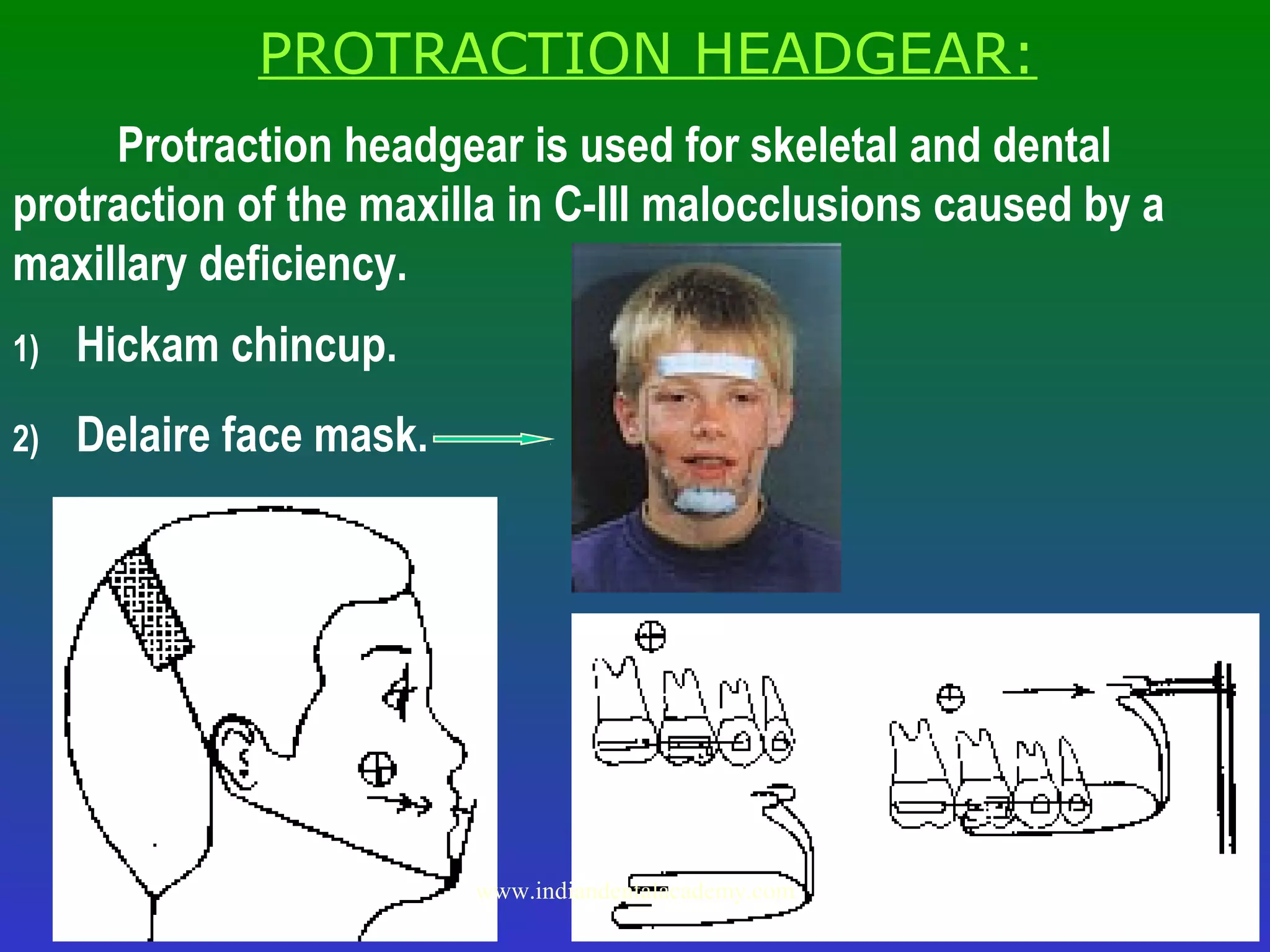 Biomechanics in orthopedics | PPT