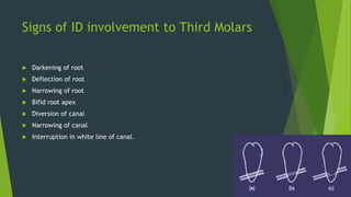 Nerve Involvement in Oral Surgery | PPTX