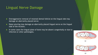 Nerve Involvement in Oral Surgery | PPTX
