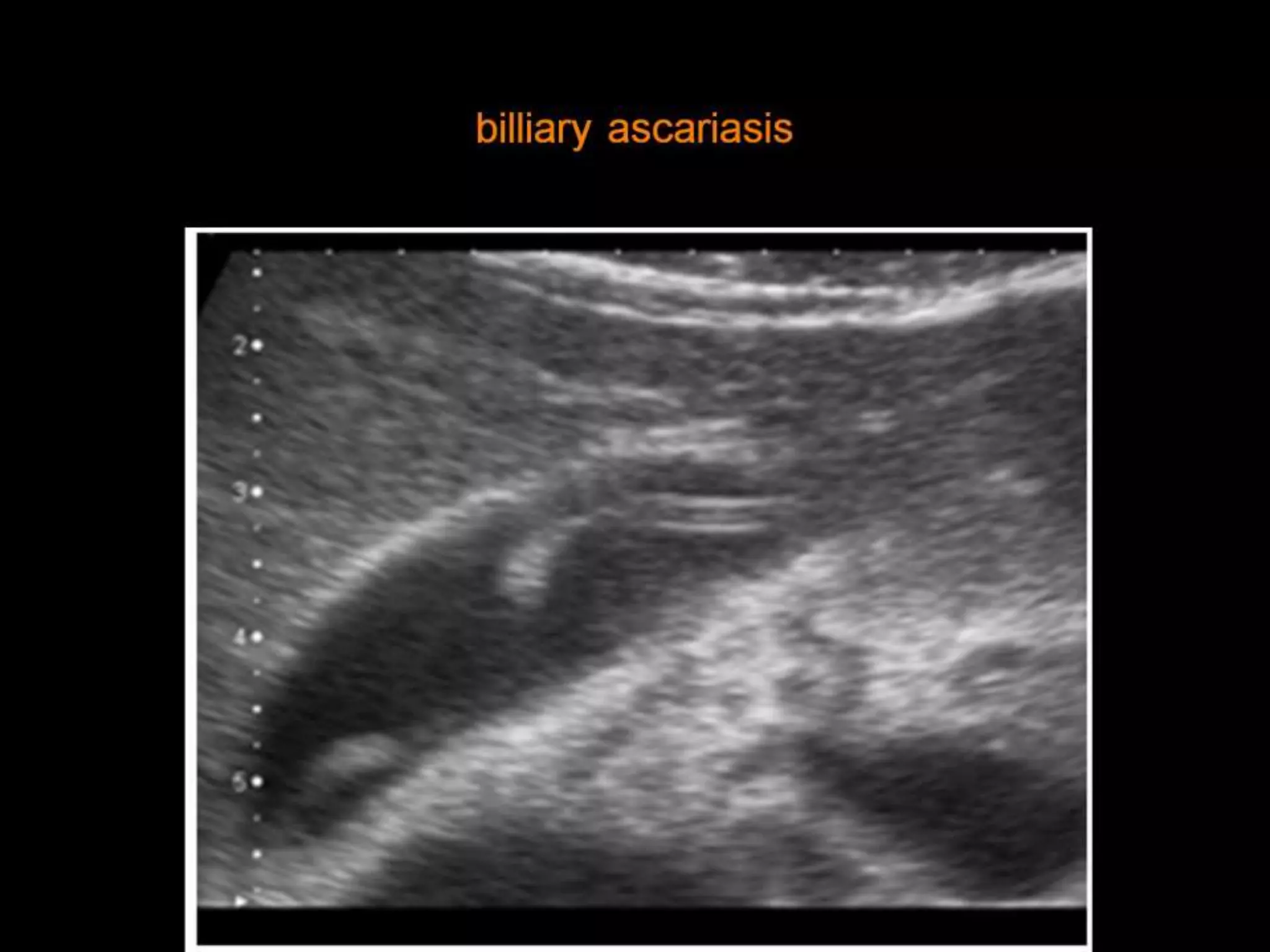 36-Dr Ahmed Esawy imaging oral board of biliary gall bladder imaging | PPT