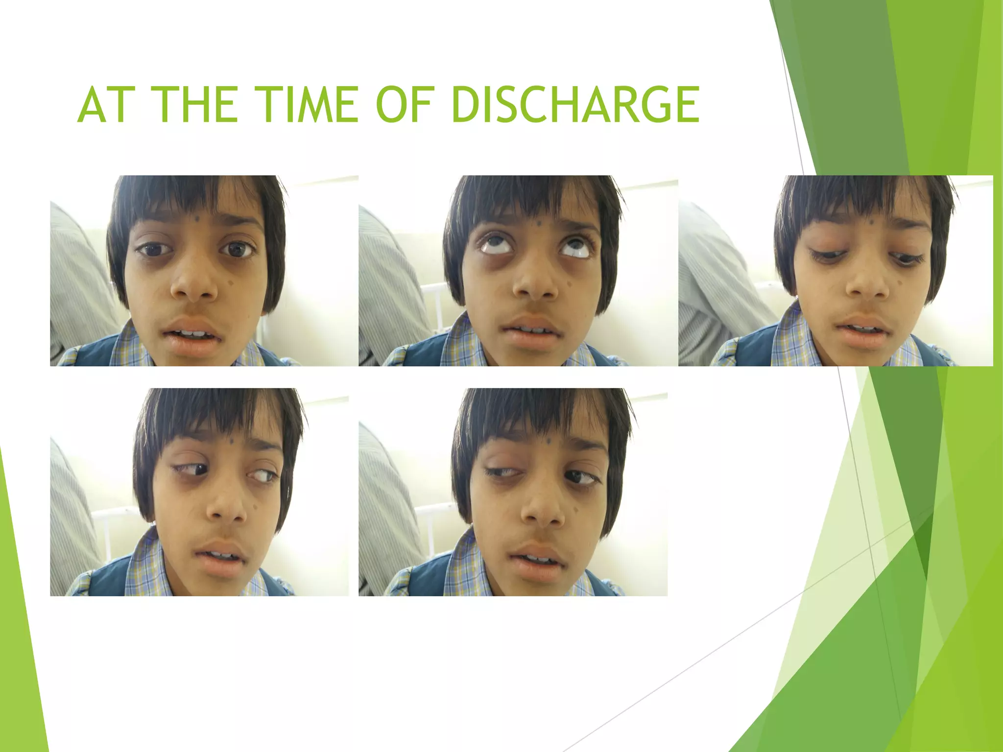 Orbital Hemorrhage Following Trivial Trauma | PPT