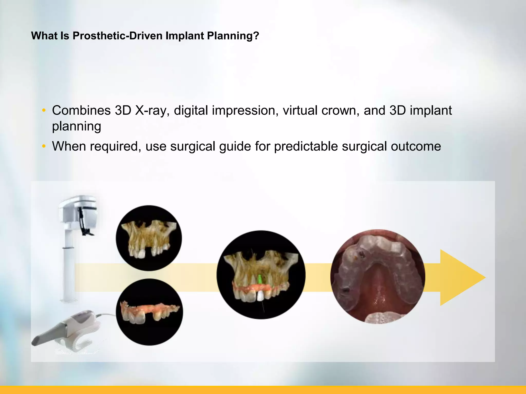 360 Visualise CarestreamPDIP Presentation | PPTX