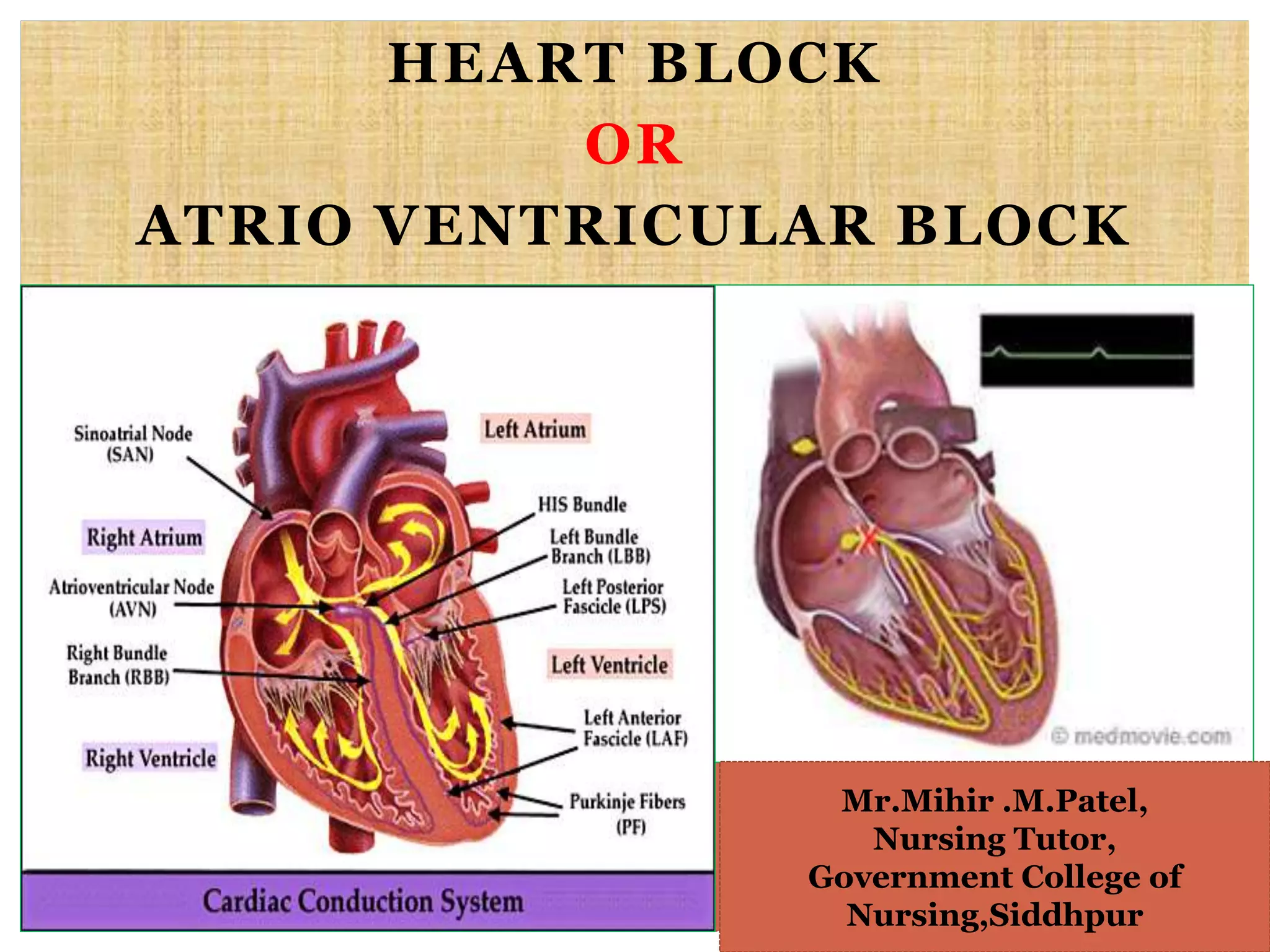 361711208-Heart-Block-ppt.pptx