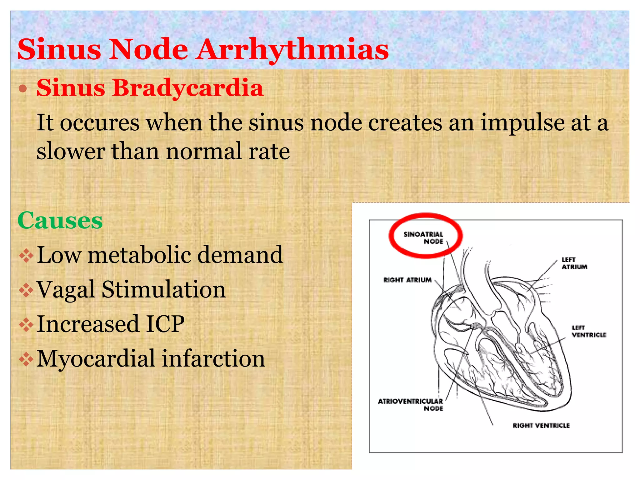 361711208-Heart-Block-ppt.pptx