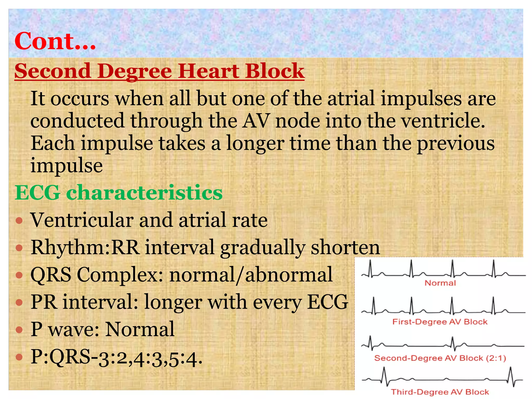 361711208-Heart-Block-ppt.pptx
