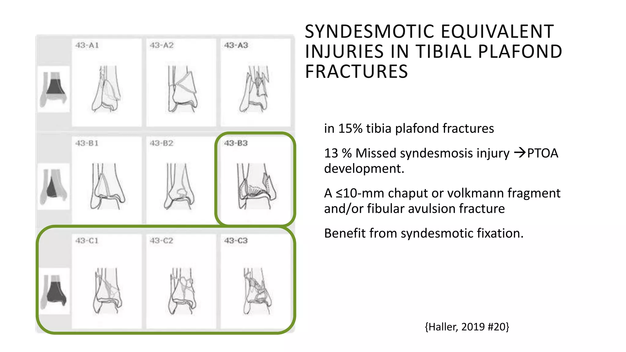 Ankle fracture : Syndesmosis Injury | PPTX
