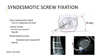 Ankle fracture : Syndesmosis Injury | PPTX