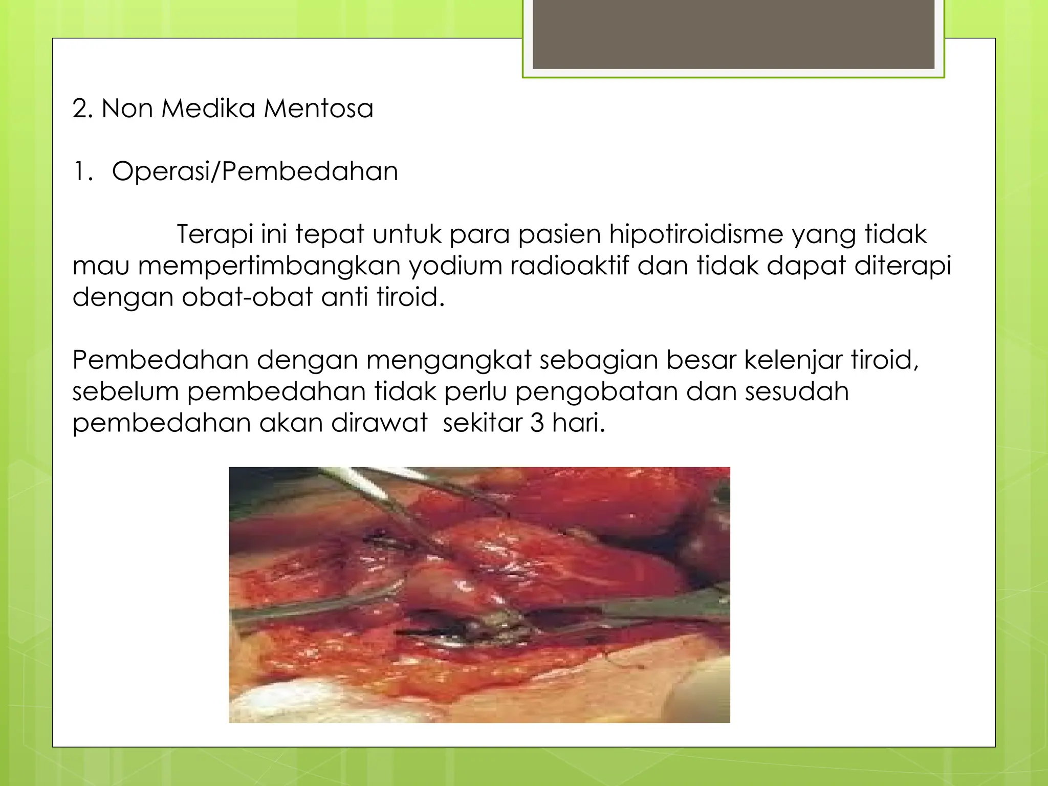 365014593-aStruma-Nodosa-Non-Toksik.pptx