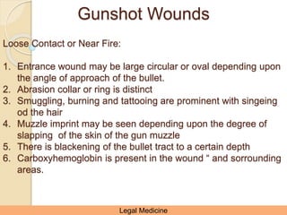365619770-Legal-MEdicine.pptx