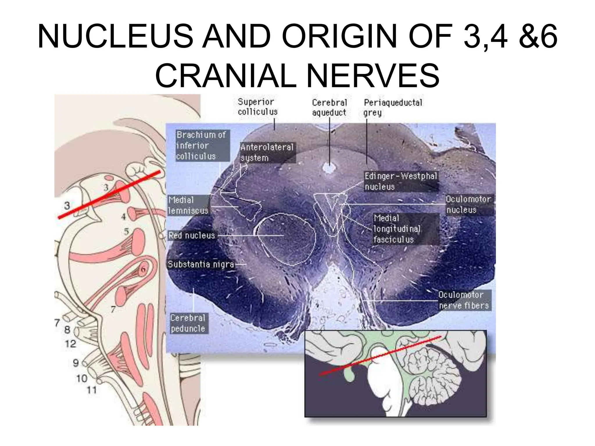 367014512-3-4-6-CRANIAL-NERVES-ppt.ppt