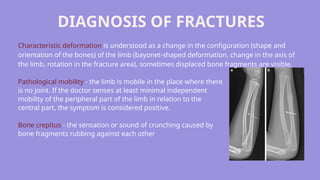 General Medicine, General Surgery. Fractures | PPTX