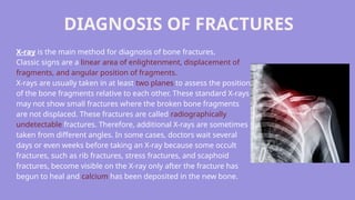 General Medicine, General Surgery. Fractures | PPTX