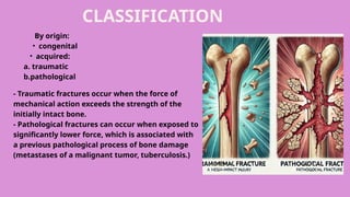 General Medicine, General Surgery. Fractures | PPTX
