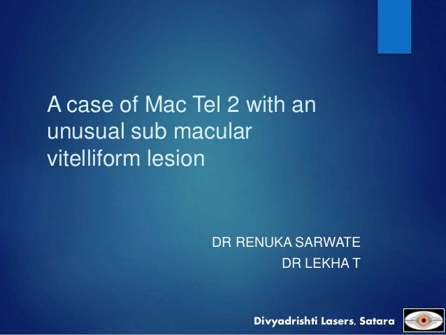 A Case Of Mac Tel 2 With An Unusual Sub Macular Vitelliform Lesion