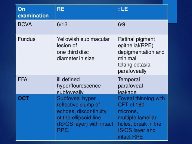 A Case Of Mac Tel 2 With An Unusual Sub Macular Vitelliform Lesion