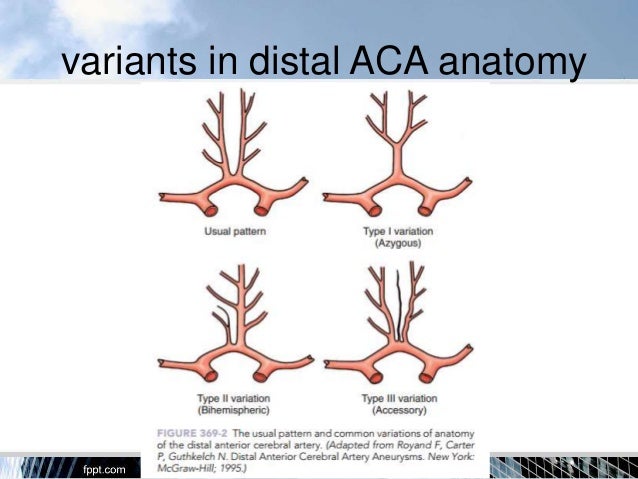 369 Microsurgery of DACA