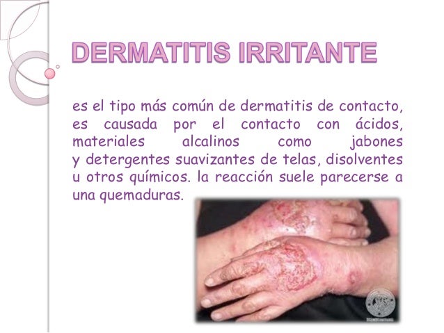 36 dermatitis de contacto