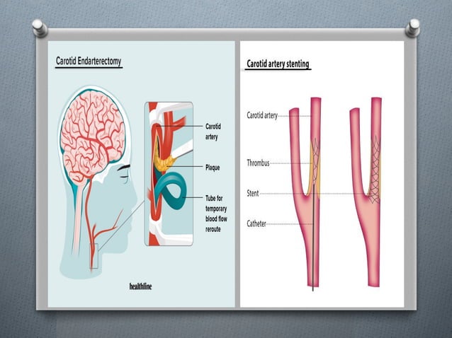 36 Pakshaghat.PowerPoint presentation ppt | PPT