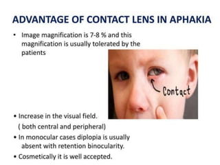 37.1 CL FOR APHAKIA.pptx