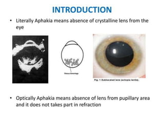 37.1 CL FOR APHAKIA.pptx