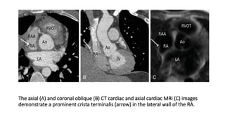 37.imaging of cardiac anatomy and pericardium.pptx