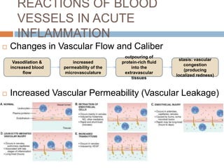Inflammation and repair | PPTX | Blood Disorders | Diseases and Conditions