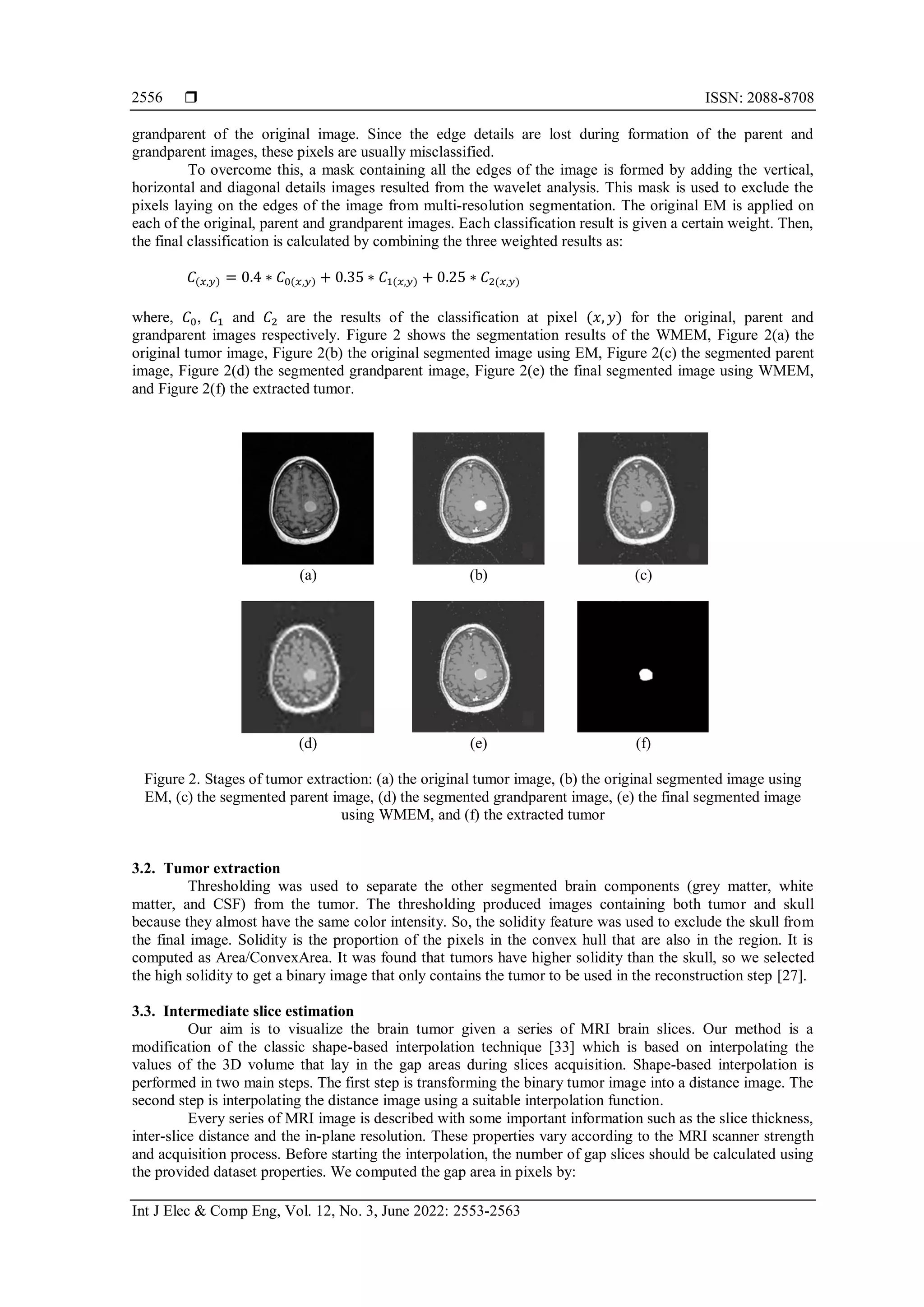 Brain tumor visualization for magnetic resonance images using modified shape-based interpolation ...
