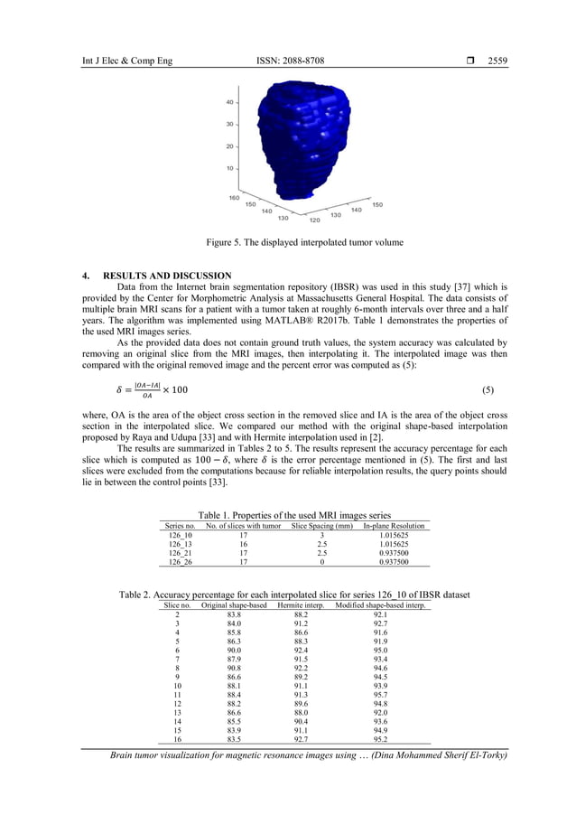 Brain tumor visualization for magnetic resonance images using modified shape-based interpolation ...