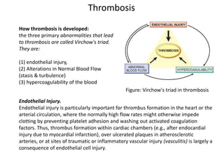 Hemodynamic disorder | PPT