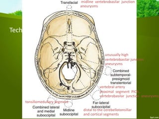 371 Microsurgery of VA PICA VBJ aneurysm | PPTX